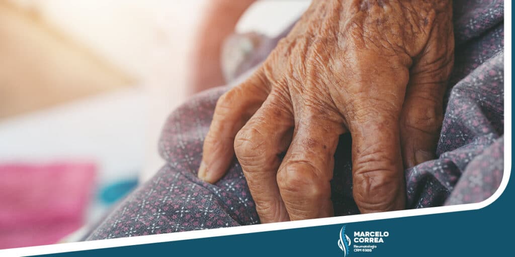 Gota - sintomas, diagnóstico e possíveis tratamentos.