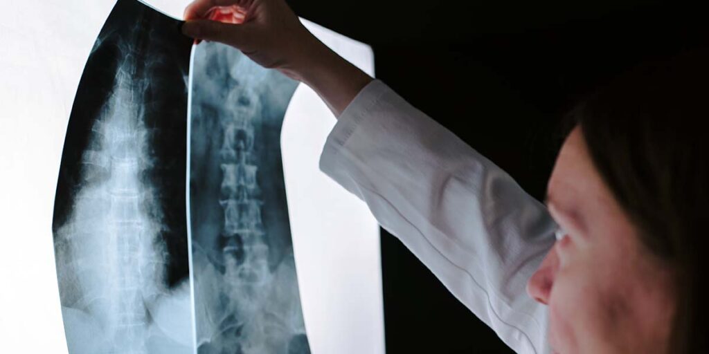 Problemas na coluna:os mais comuns e como amenizar a dor