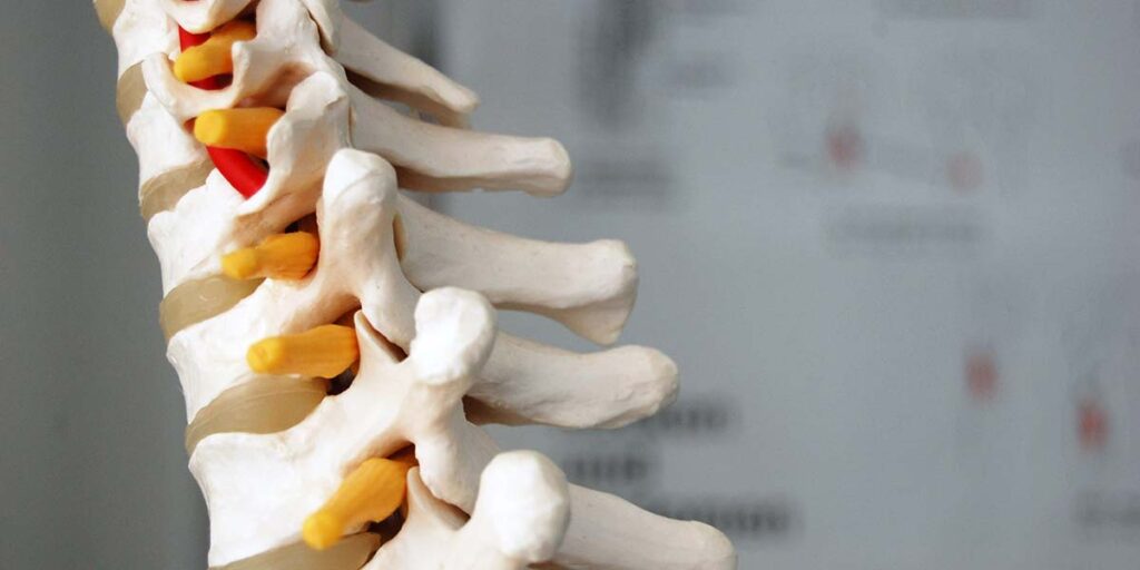 Coluna inflamada: causas e tratamentos reumatológicos.